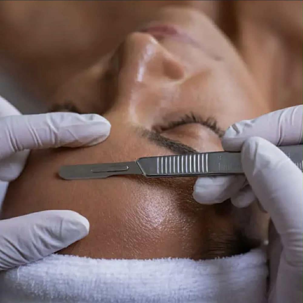 Delux Dermaplane Facial - The Perfect Tan & Beauty